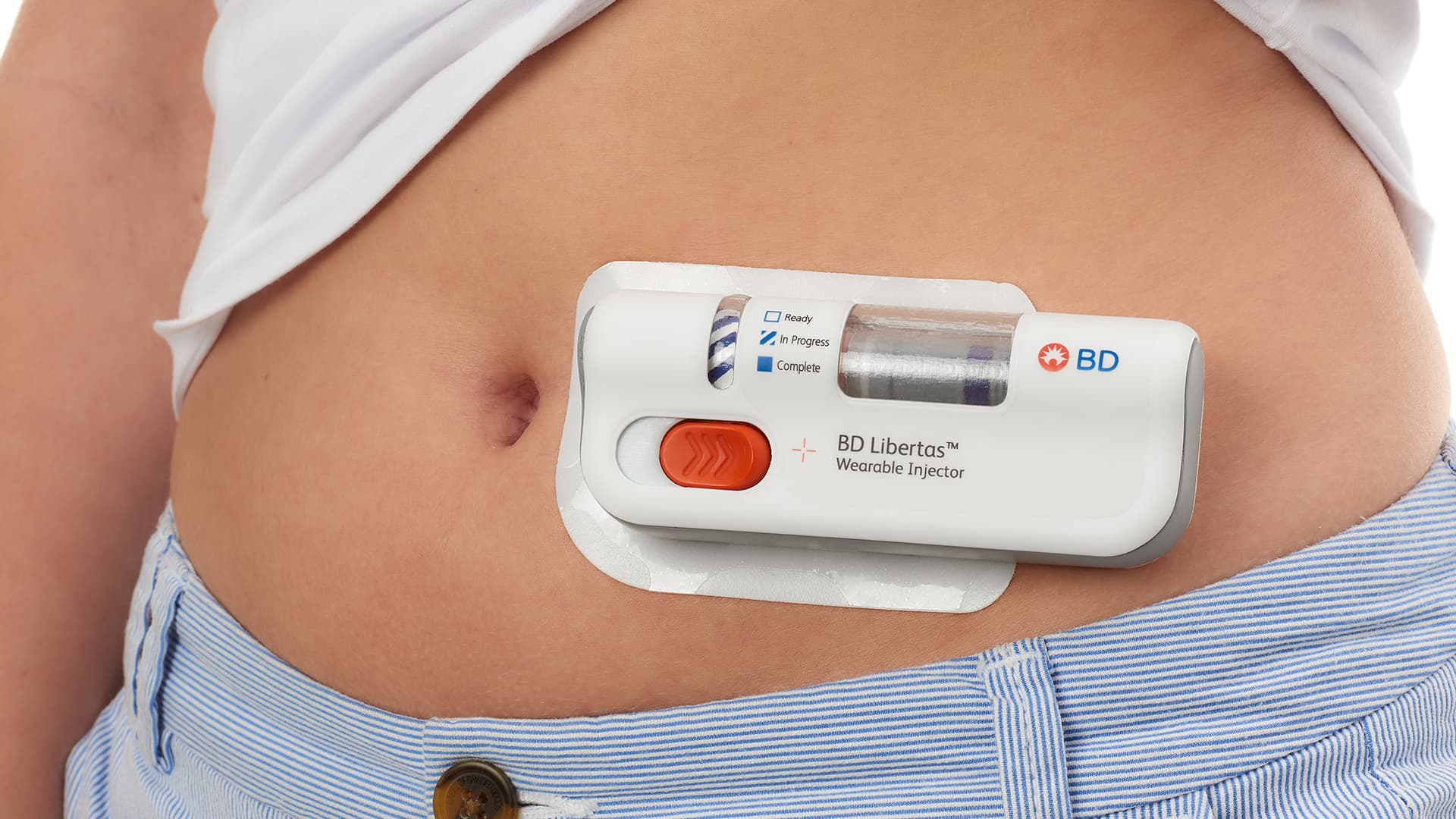 Large volume Subcutaneous self-administered injection by means of a ...